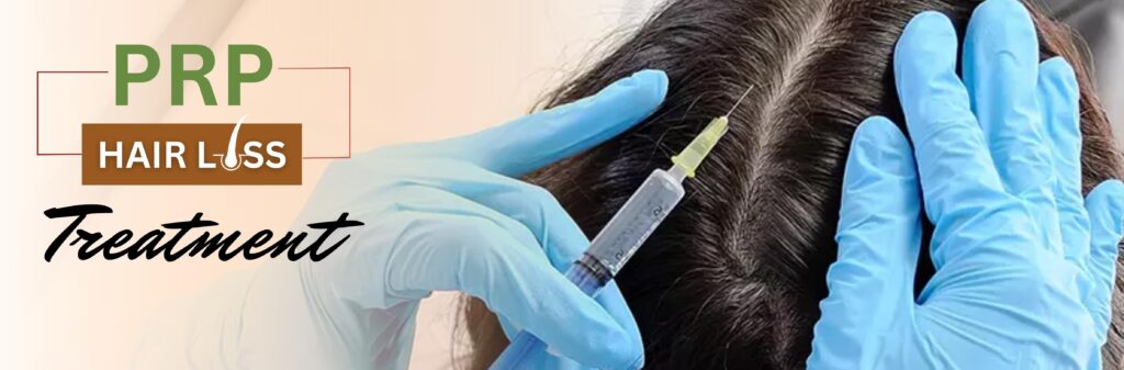 PRP for Hair Loss - Skin Revive MD SPA - Med Spa